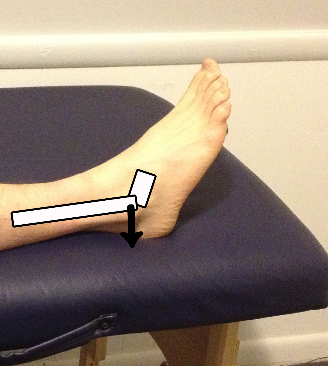 Acute Inversion Ankle Sprains - The Other 6-8 Hours | Dynamic Principles